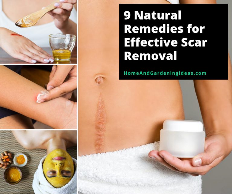 9 Natural Remedies for Scar Removal - Home and Gardening Ideas